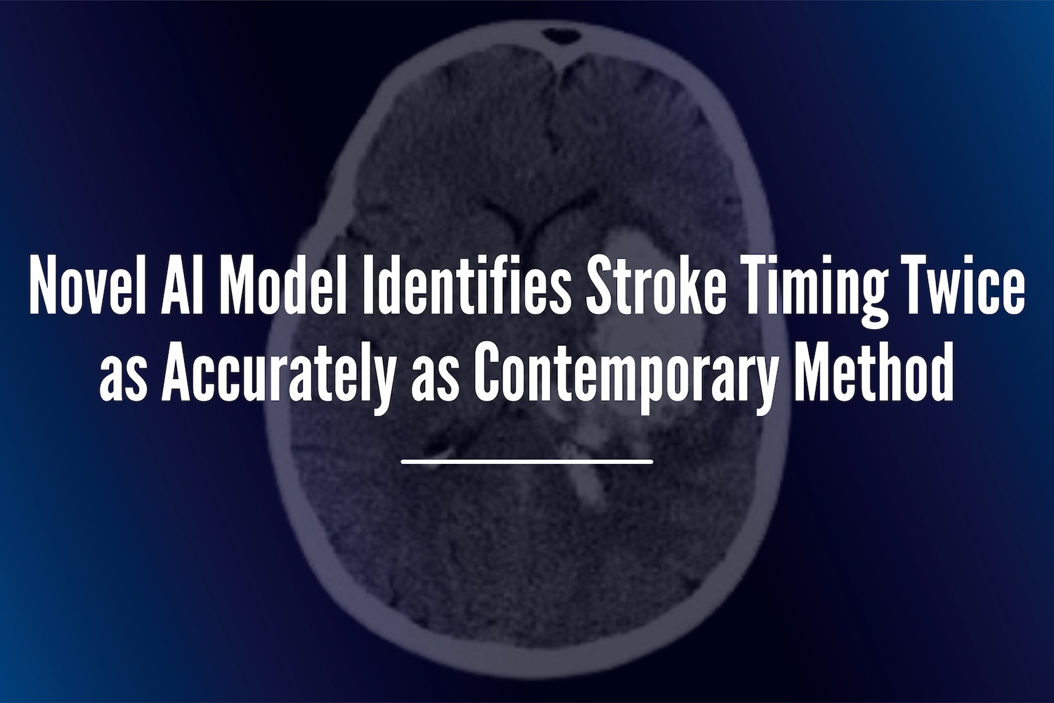 Novel AI Model Identifies Stroke Timing Twice as Accurately as ...